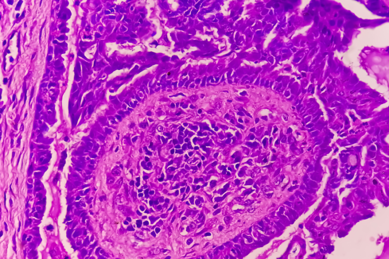 Essential Endometrial Biopsy After-Care Tips - Women's Health Associates